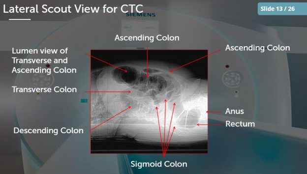CT Registry Review